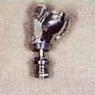 Cusp Fossa Above Vs Cusp Embrasure Occlusion From McNeill C Ed Download Scientific