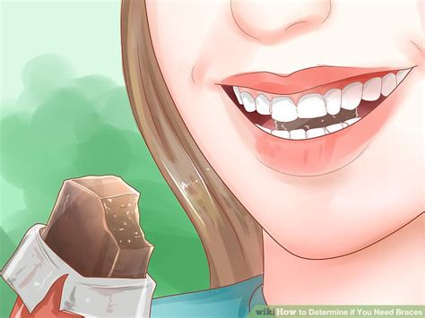 How To Determine If You Need Braces With Pictures Wikihow