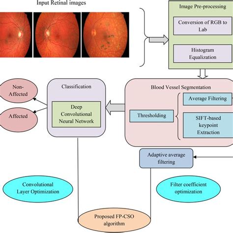 Flow Diagram Of Proposed Diabetic Retinopathy Detection Model Color Download Scientific
