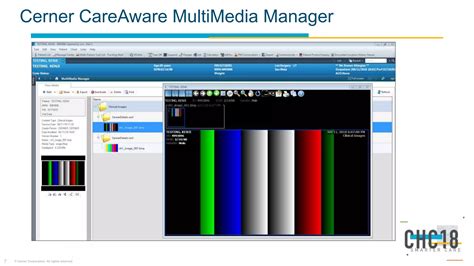 Integrating Cerner Millennium Wstryker Surgical Imaging System Pptx