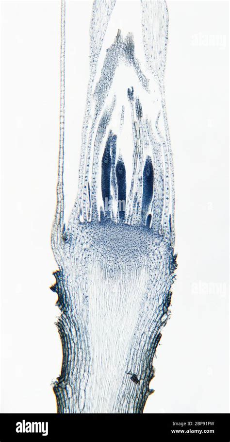 Mnium Archegonium Of Slide