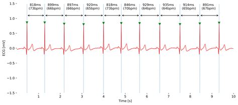 Biosignals Processing 101 Unveiling Features For Insightful Analysis