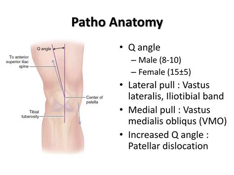 Habitual Dislocation Of Patella Pptx