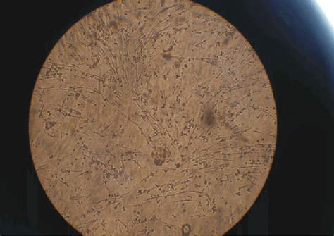 Cytopathic Effect Observed After 48 Hrs Of Incubation Download