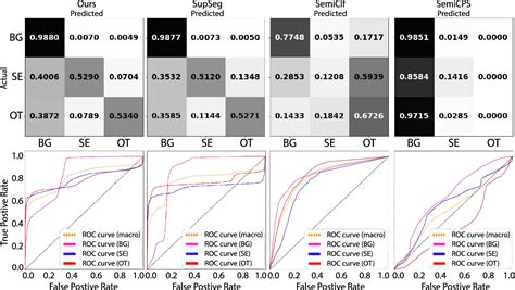 Figure 5 From Deep Semisupervised Semantic Segmentation In Multifrequency Echosounder Data