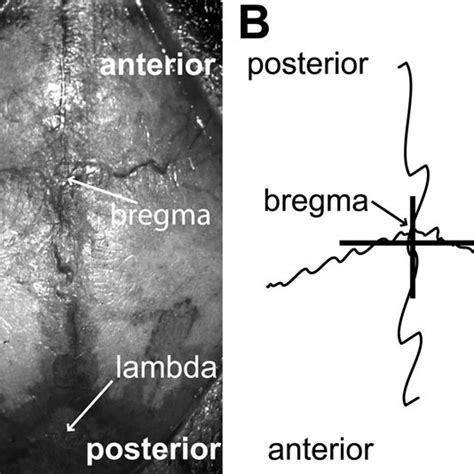 Lambda Y Bregma At Amanda Moretz Blog