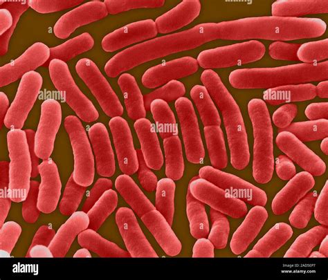 Farbige Scanning Electron Micrograph Sem Von Salmonella Typhi Ist Ein Gram Negative Enteric