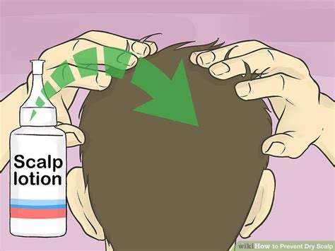 3 Ways To Prevent Dry Scalp WikiHow Health