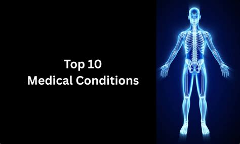 Understanding Goiter Thyroid Nodules And Thyroiditis Via Imaging