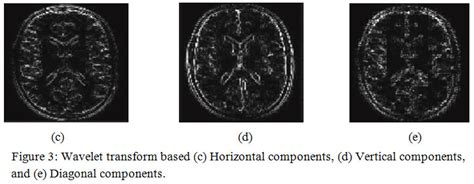 Analysis And Comparison Of Wavelet Transforms For Denoising Mri Image Biomedical And