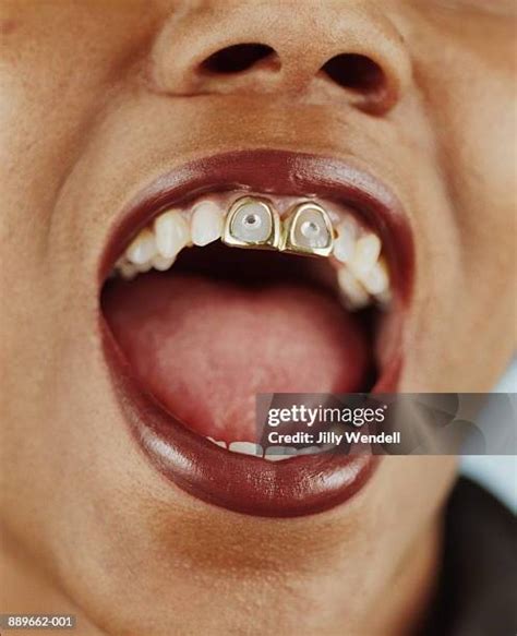 Gold Front Teeth Photos And Premium High Res Pictures Getty Images
