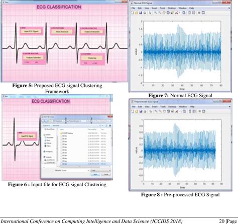 Figure 1 From Clustering The Ecg Signals Using Fuzzy C Means Clustering Technique Semantic Scholar