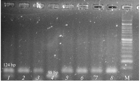 Agarose Gel Electrophoresis Of Restriction Fragments To Determine The Download Scientific