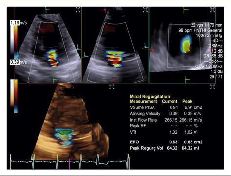 Figure 1 From Automated Quantification In Echocardiography Semantic Scholar