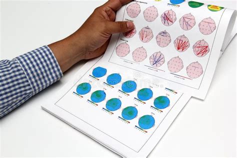 Brain Mapping Done By A Neurologist Doctor With Neuroscience Technique Done Cartography Spatial