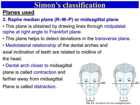 Classifcation Of Malocclusion Pptx