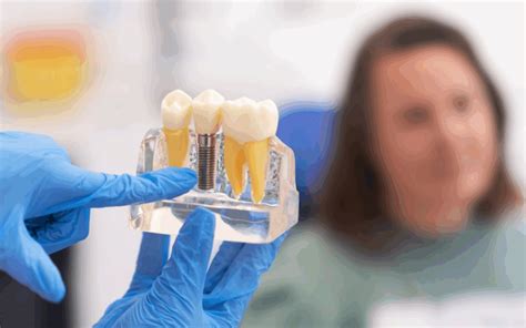 Lisp After Dental Implants — How To Fix It