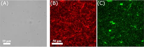 Quantifying Cytoskeleton Dynamics Using Differential Dynamic Microscopy
