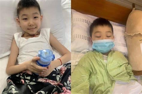 Э Ананд хүүгийн шинжилгээгээр цycны Xopт Xaвдap гэсэн давхар онош илэрчээ