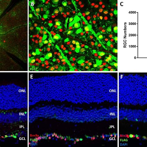 Aav2 Transduction Profile And Rgc Transduction Efficiency Following
