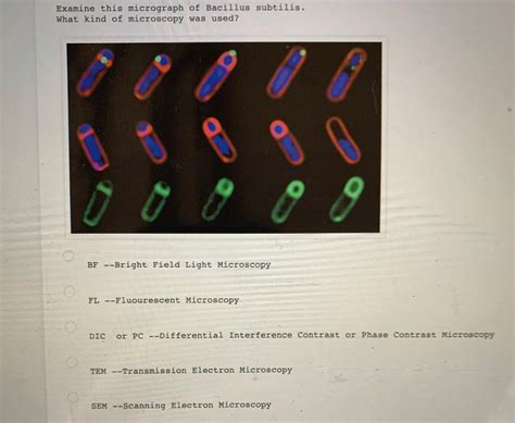 Solved Examine This Micrograph Examining The Synapse Between