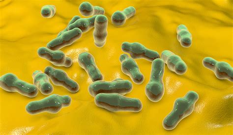 Necrosis What Is Types Symptoms Risk Factors And Treatment