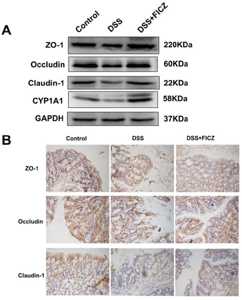 Ficz Prevents Dss Induced Disruption Of Tj A Expressions Of Tj Download Scientific Diagram
