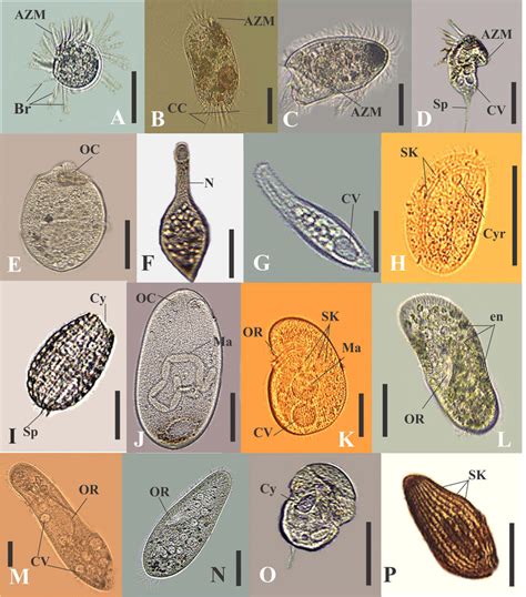 Ciliophora Paramecium