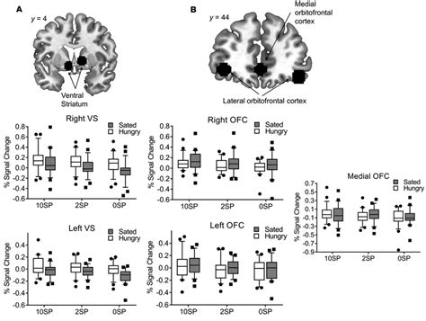 Neural Activation During The Expectation And Receipt Of Food Reward Is Download Scientific