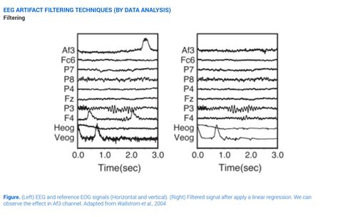 Eeg Artifacts Types Detection And Removal Techniques Bitbrain