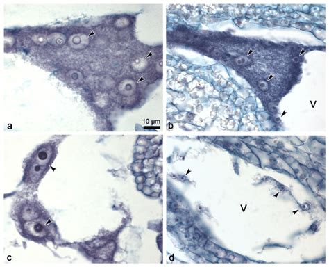 Multinuclear Autonomous Endosperm Ae2 Induced In Vitro Longitudinal Download Scientific