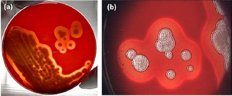 Haemophilus Blood Agar Sheep Blood Agar Royalty Free Images Stock