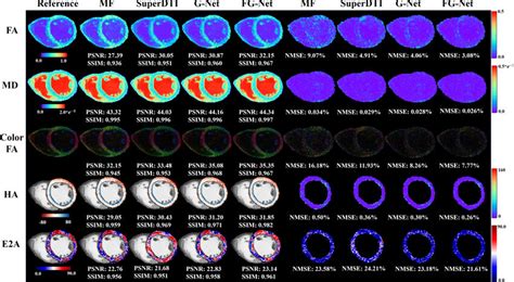 The Representative DTI Parameter Maps Of The First Dataset Obtained Download Scientific Diagram