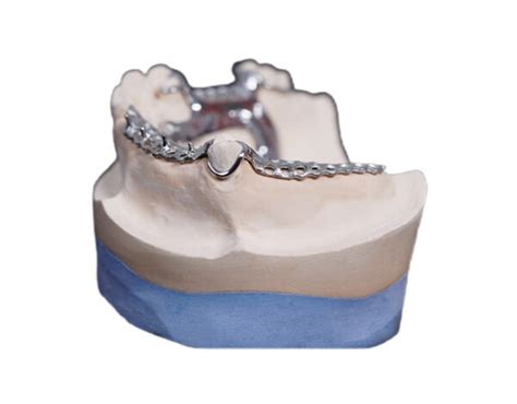 Partial Framework Fitclean