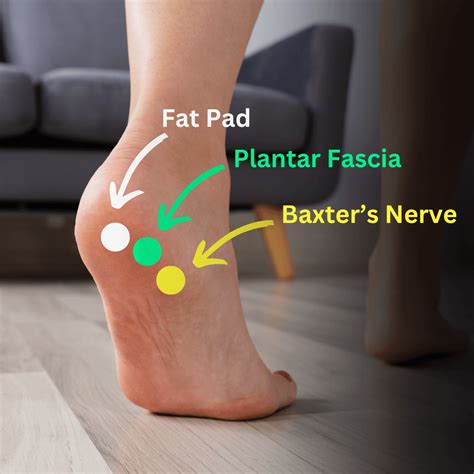 Heel Pad Syndrome Vs Plantar Fasciitis Epomedicine