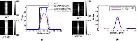 Use Of Split Bregman Denoising For Iterative Reconstruction In