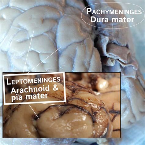 Neuroanatomy Glossary Arachnoid Mater Ditki Medical And Biological Sciences