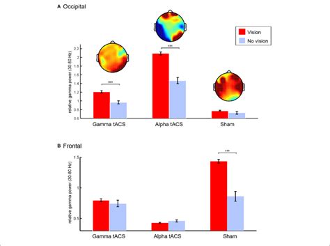 Gamma Oscillations During Spontaneous Visual Imagery A Right