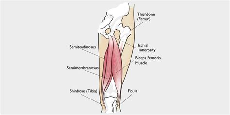 Hamstring Tendonitis The Complete Injury Guide Vive Health