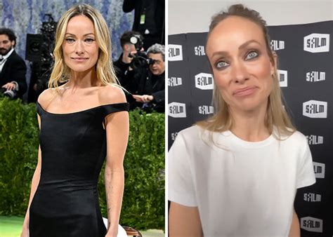 Met Gala 2026 Was More About Plastic Surgery Than Fashion As Stars
