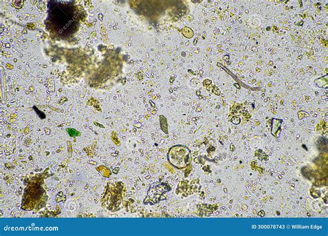 Microorganisms And Biology In Compost And Soil Sample Under The