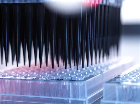 Expert Pre Analytical Work Processing