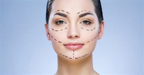 Geometric Technique For Botox Injection Sites And Which Areas To Avoid