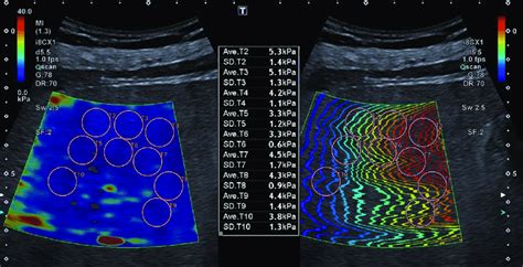 Example Of The Ten Roi In One Acquisition Example Picture Of One