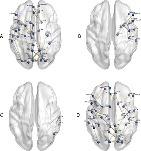 Reorganization Of Brain Networks In Patients With Temporal Lobe Epilepsy And Comorbid Headache