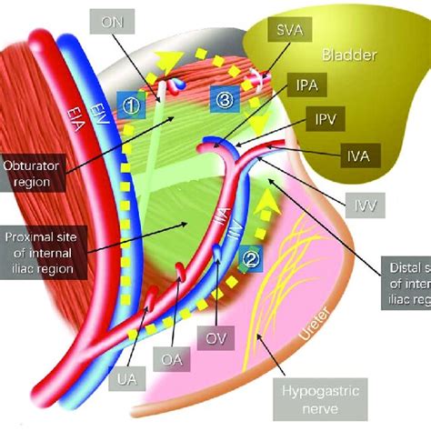 Fascial Spaces And Dissection Areas Of Lateral Lymph Node Dissection