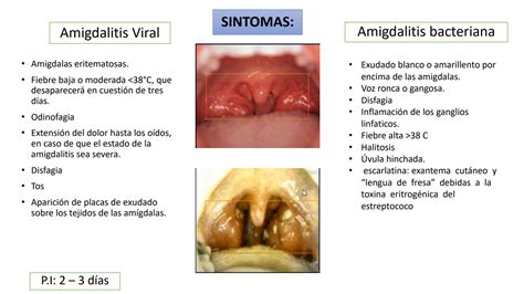 Solution Amigdalitis Y Faringitis Aguda Studypool