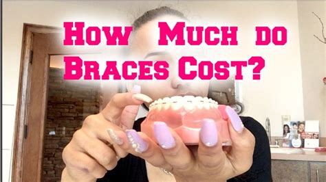How Much Do Braces Cost Contract Explanation Youtube