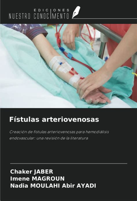 Fistulas Arteriovenosas Creacion De Fistulas Arteriovenosas Para