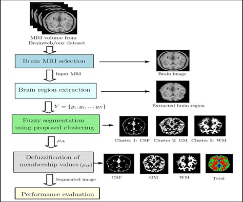 Block Diagram Of The Proposed Segmentation Method The Result For Each Download Scientific
